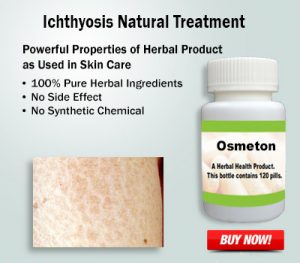 Osmeton for Herbal Supplement for Ichthyosis