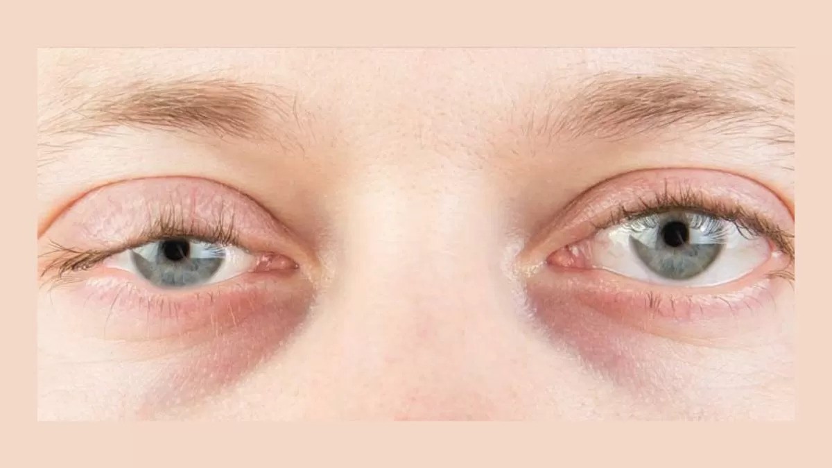 What's Happening: The Weakening of Eye Muscles Explained